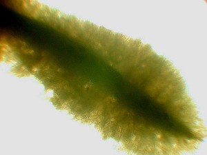 Freshwater sponge gemmule under the microscope – Quekett Microscopical Club