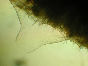 Freshwater sponge gemmule under the microscope – Quekett Microscopical Club