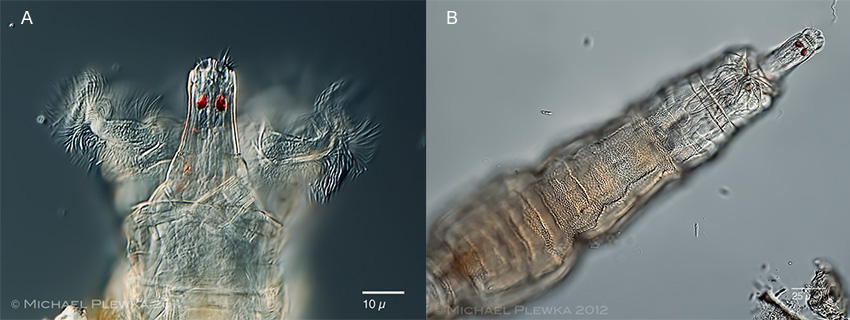Bdelloid rotifers, by Aydin Örstan & Michael Plewka – Quekett ...