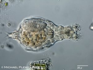 Bdelloid rotifers, by Aydin Örstan & Michael Plewka – Quekett ...