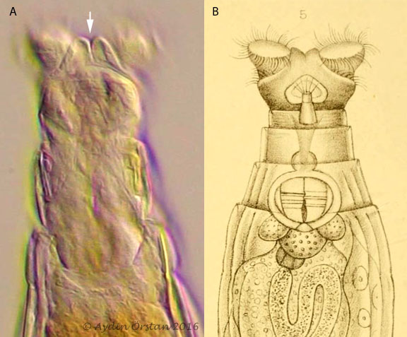 Bdelloid rotifers, by Aydin Örstan & Michael Plewka – Quekett ...