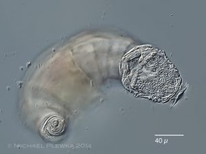 Bdelloid rotifers, by Aydin Örstan & Michael Plewka – Quekett ...
