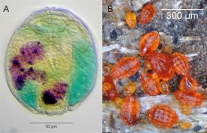 Bdelloid rotifers, by Aydin Örstan – Quekett Microscopical Club