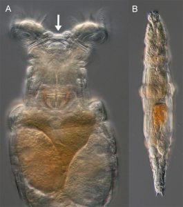 Bdelloid rotifers, by Aydin Örstan – Quekett Microscopical Club
