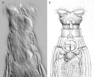 Bdelloid rotifers, by Aydin Örstan – Quekett Microscopical Club