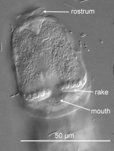 Bdelloid rotifers, by Aydin Örstan – Quekett Microscopical Club