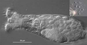 Bdelloid rotifers, by Aydin Örstan – Quekett Microscopical Club